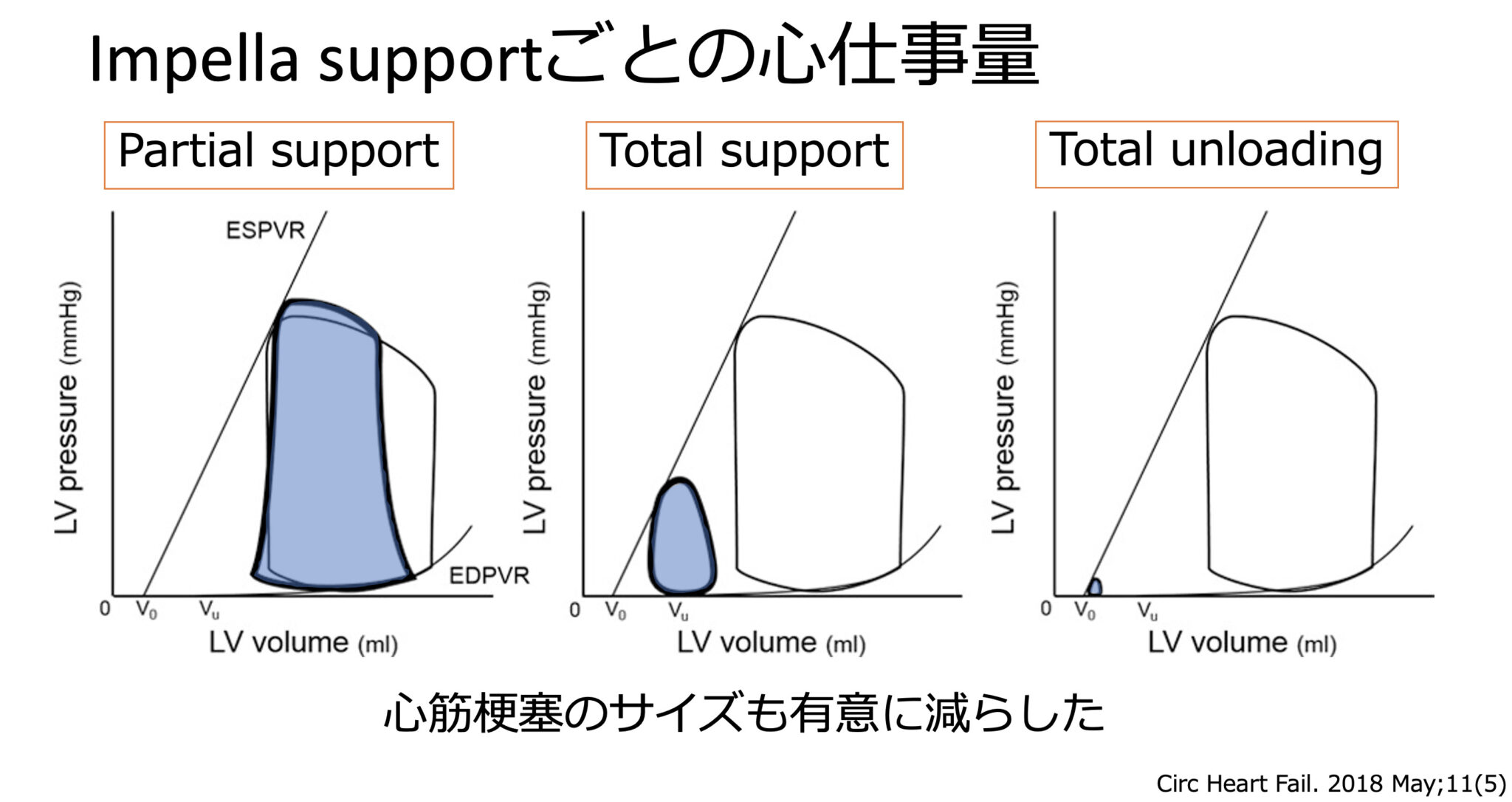 心原性ショックと補助循環Impella